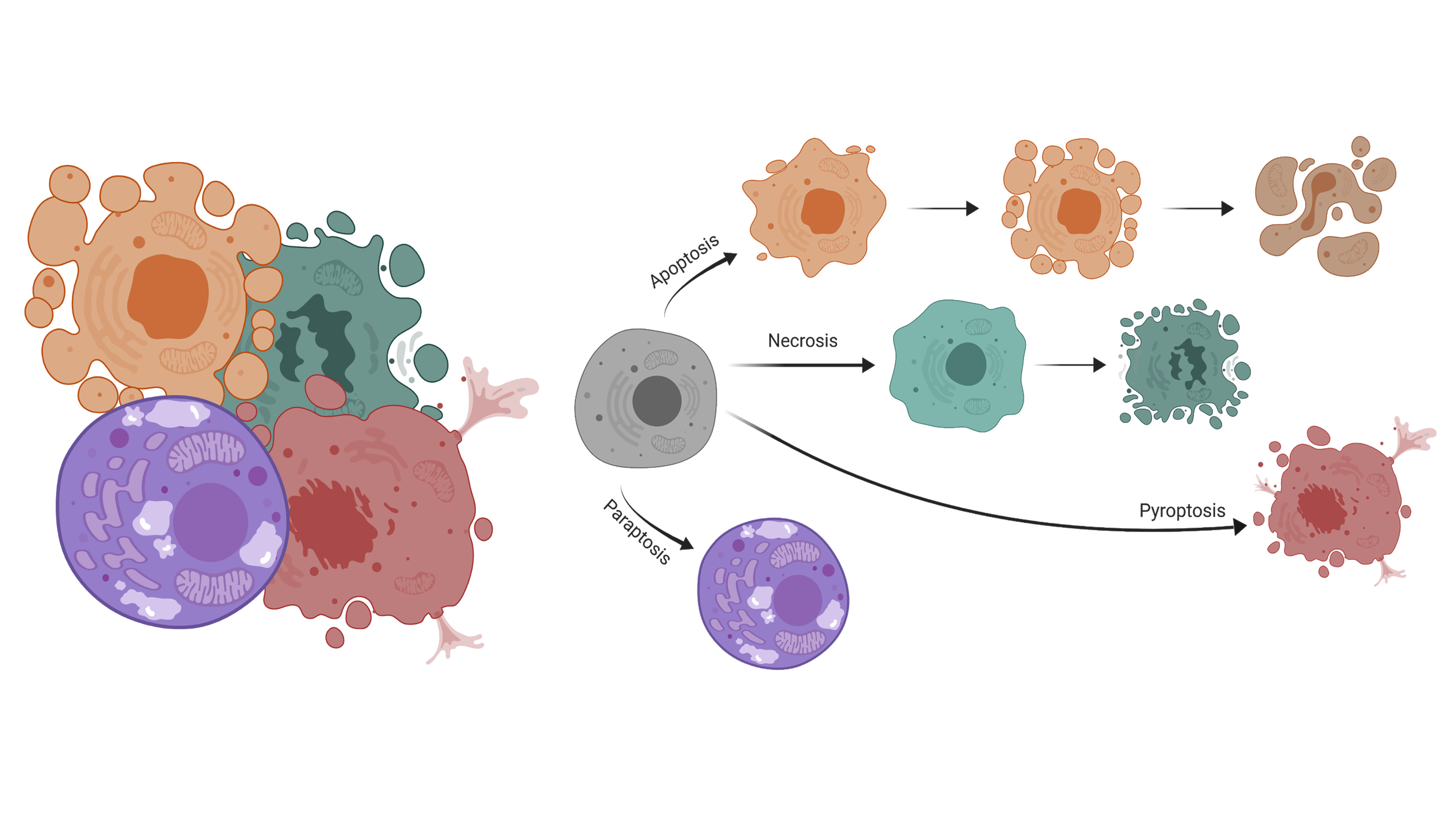 Preventing cell death decreases breast cancer recurrence – OncoBites
