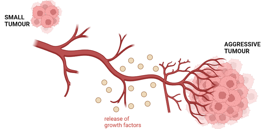 Anti-Angiogenic Cancer Treatments – OncoBites