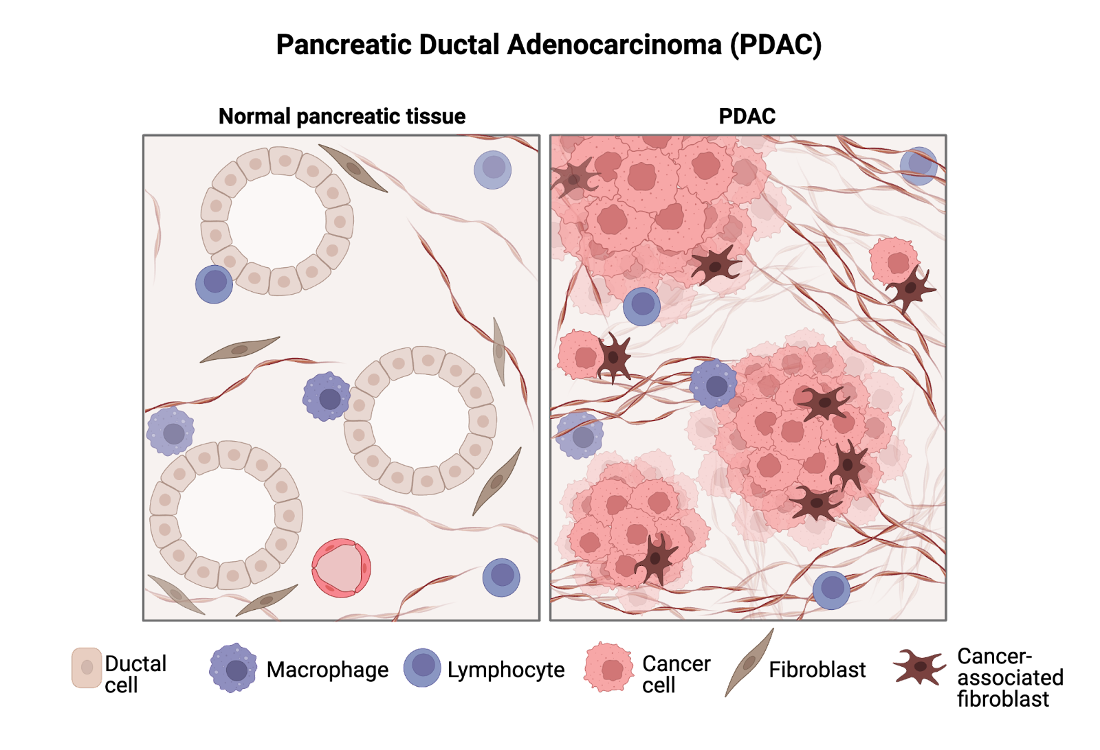 The Dual Role of Cancer-Associated Fibroblasts in Pancreatic Ductal ...