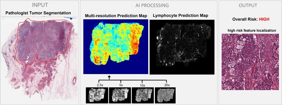 AI vs. Traditional Methods in Cancer Diagnostics – OncoBites