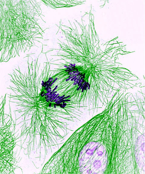 The Right Dosage of Taxanes – What happens after a Taxane toxicity ...